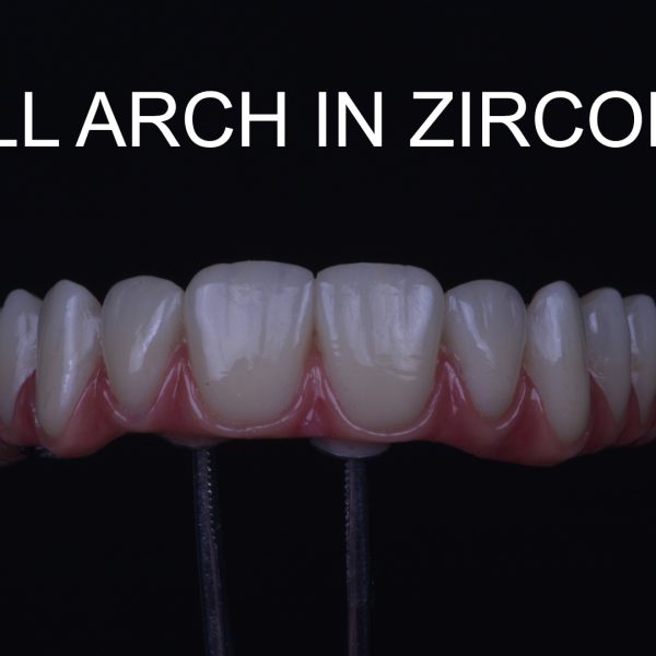 RIABILITAZIONE FULL-ARCH IN ZIRCONIA | Laboratorio Odonto Protesico